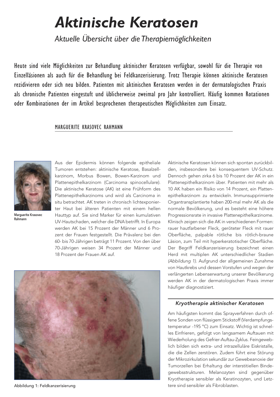 Actikerall: Anwendung, Wirkung und Tipps für effektive Behandlung