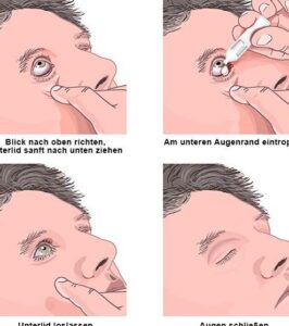 Augensalbe richtig anwenden: Tipps und Anleitung für optimale Ergebnisse