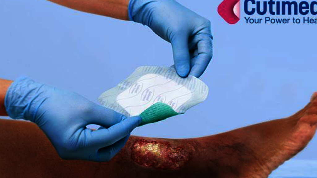 Cutimed Sorbact Anwendung – Effektive Wundbehandlung Tipps