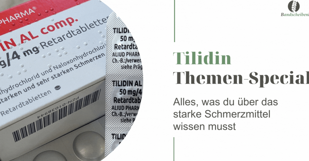Tilidin Anwendung: Informationen und Tipps zur richtigen Einnahme
